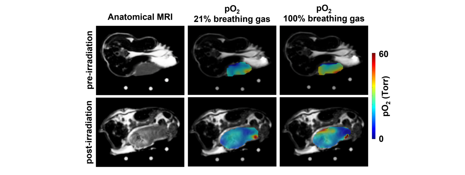 Oxygen Imaging and Tumor Radiotherapy - O2M Technologies